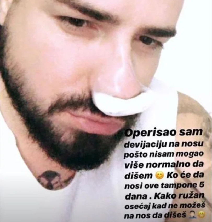 ŠTA SU POZNATI MUŠKARCI URADILI NA SEBI? Kosa, botoks, vilica, a jedan ...