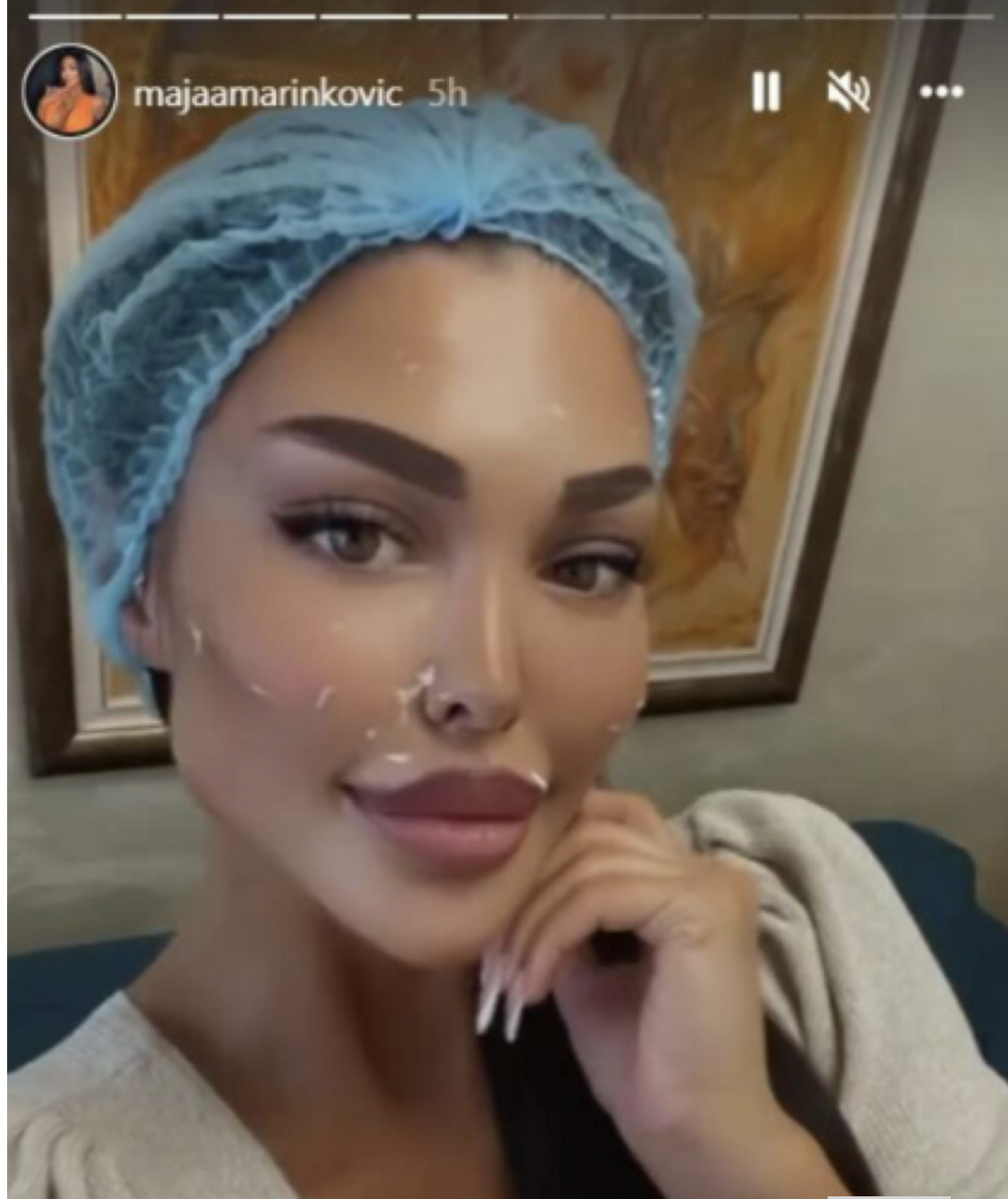 MAJA MARINKOVIĆ OPET NA REMONTU: Radila grudi, oči, usne, jagodice, nos, a sad izgleda ovako ...