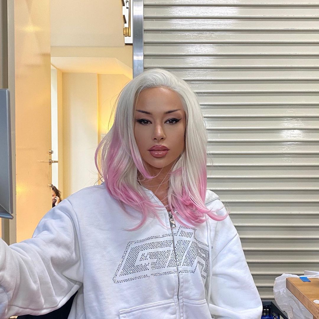 ELENA KITIĆ JE SADA NEPREPOZNATLJIVA! Pogledajte šta je sve operisala ...